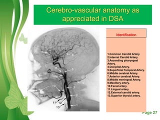 Digital subtraction angiography | PPTX