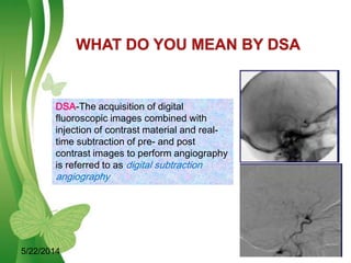 Digital subtraction angiography | PPTX