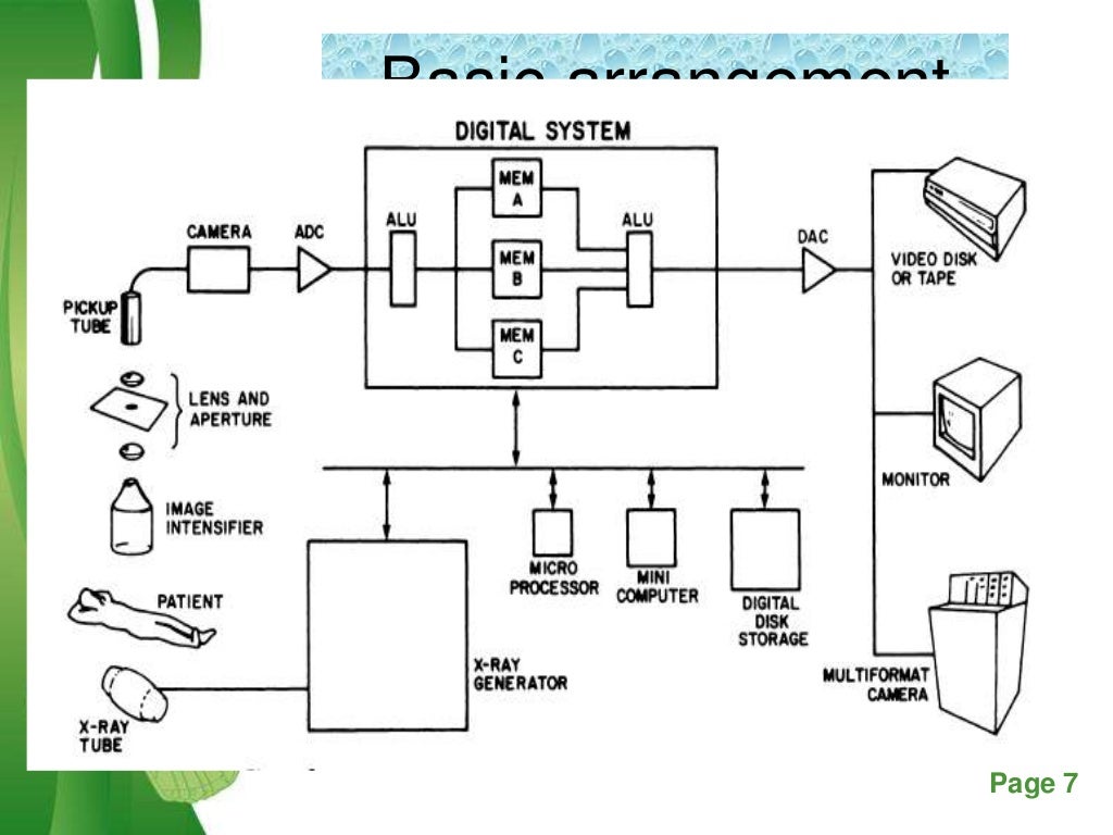 Digital subtraction angiography