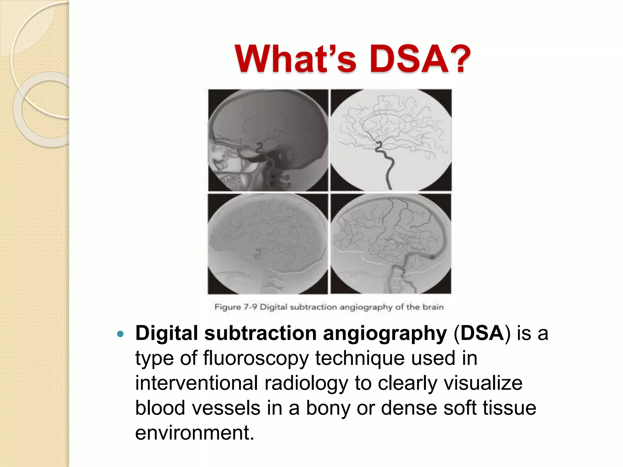 digitalsubtractionangiography-150321092516-conversion-gate01.pdf