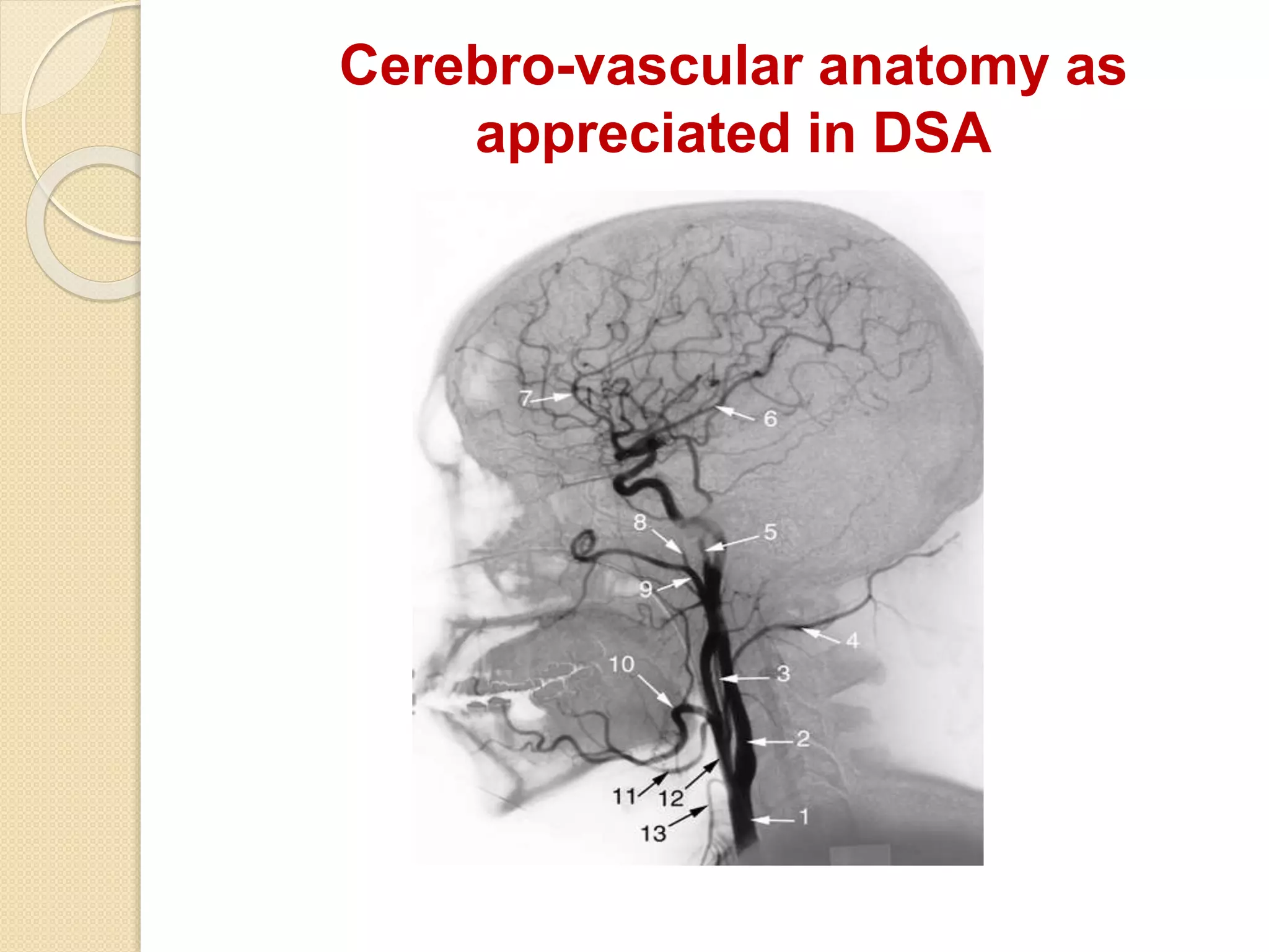 Digital subtraction angiography | PPTX