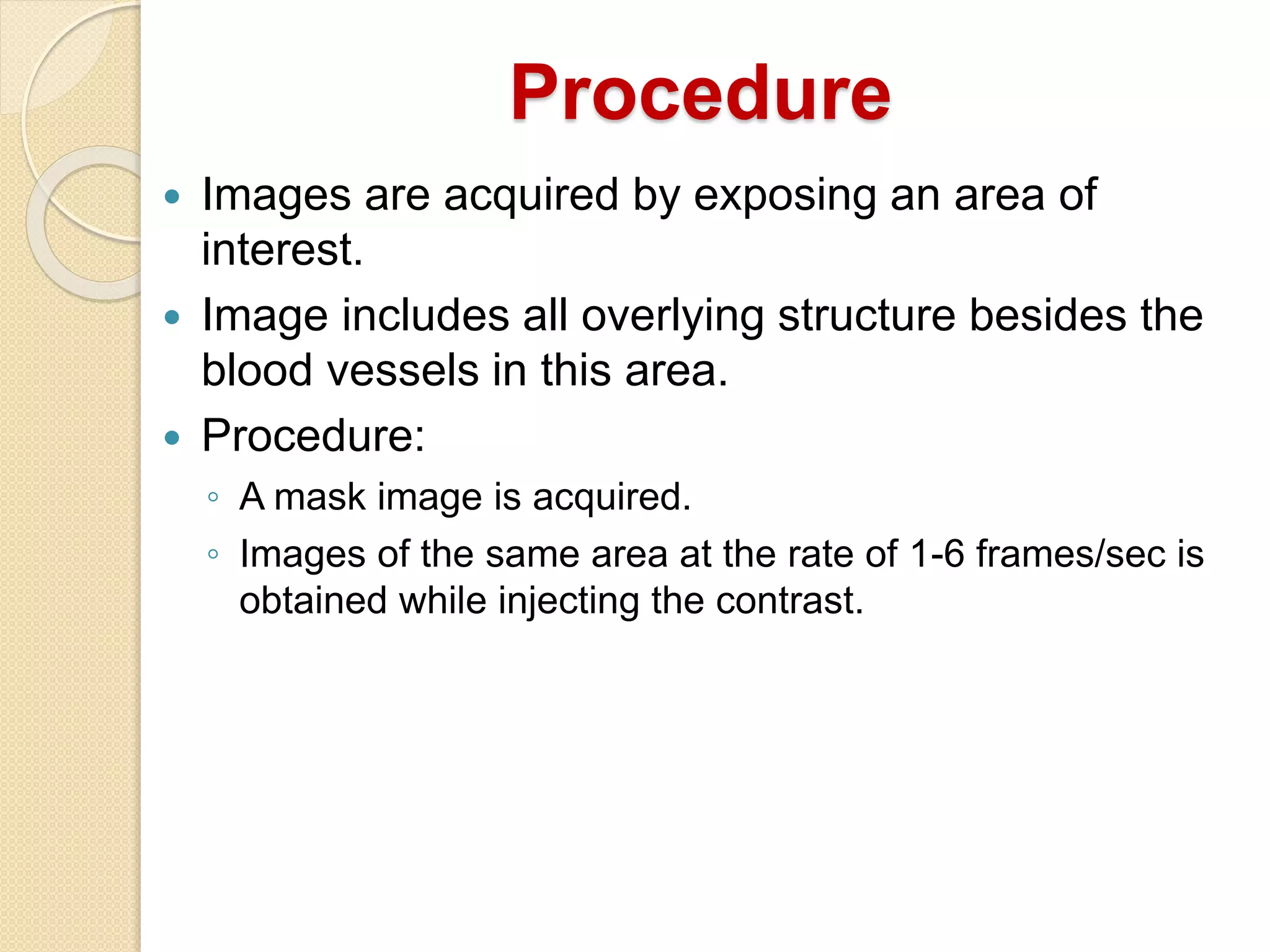 Digital subtraction angiography | PPTX