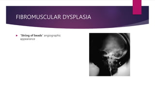 DIGITAL SUBTRACTION ANGIOGRAPHY IN CEREBROVASCULAR DISEASE AND ...