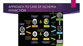 DIGITAL SUBTRACTION ANGIOGRAPHY IN CEREBROVASCULAR DISEASE AND ...