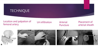 DIGITAL SUBTRACTION ANGIOGRAPHY IN CEREBROVASCULAR DISEASE AND ...