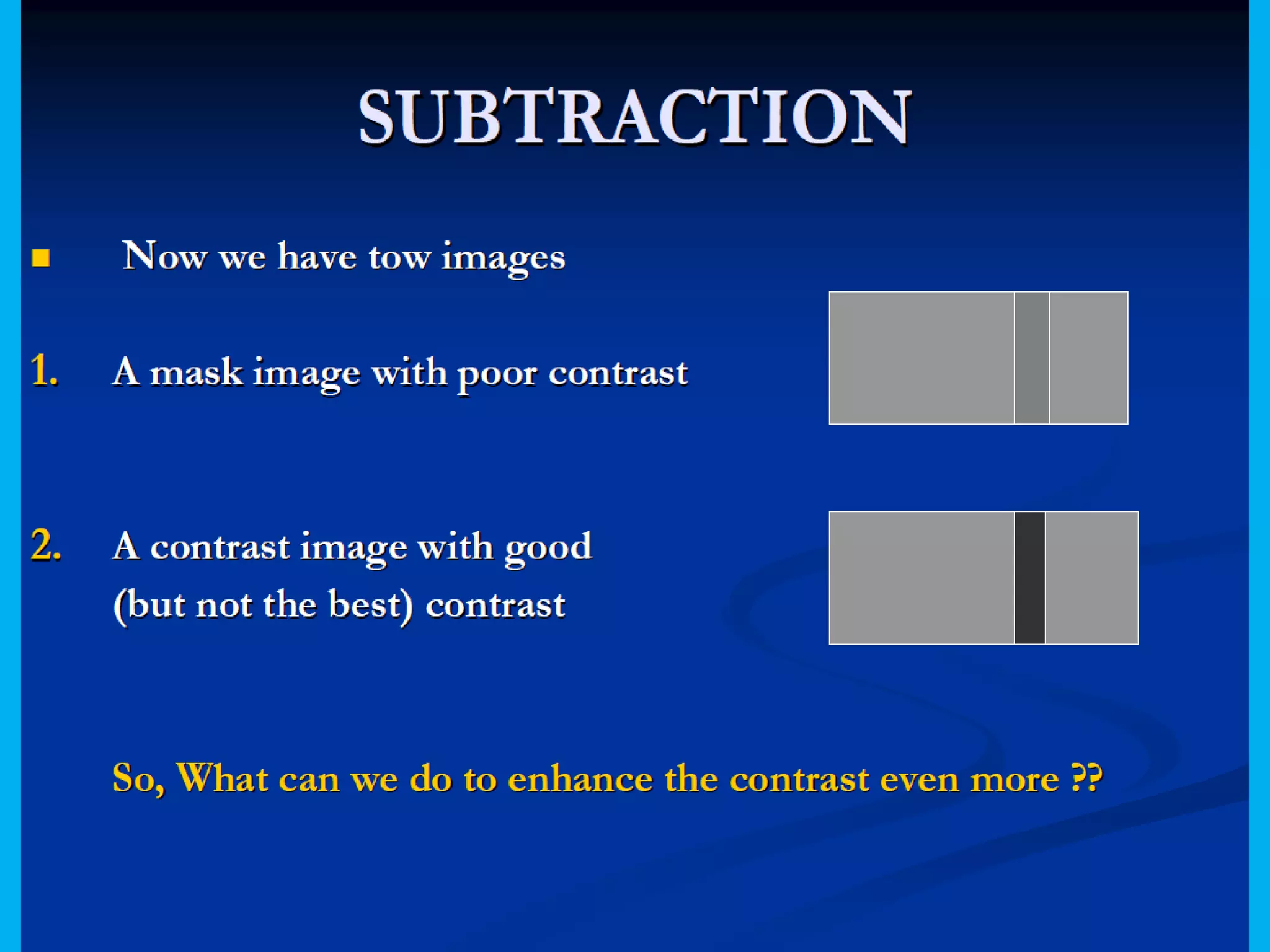 Digital Subtraction Angiography king saud unversity.pdf