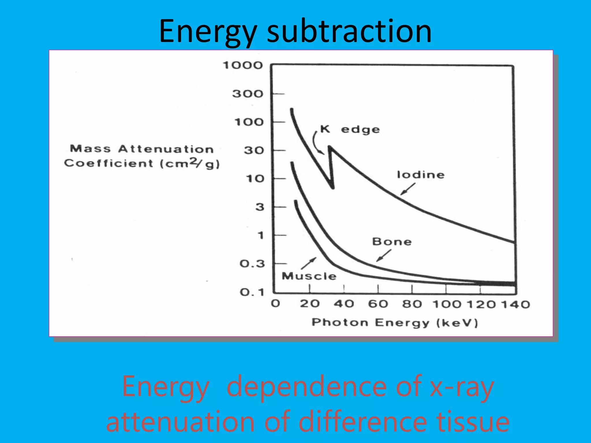 Digital Subtraction Angiography king saud unversity.pdf
