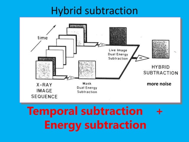 Digital Subtraction Angiography king saud unversity.pdf