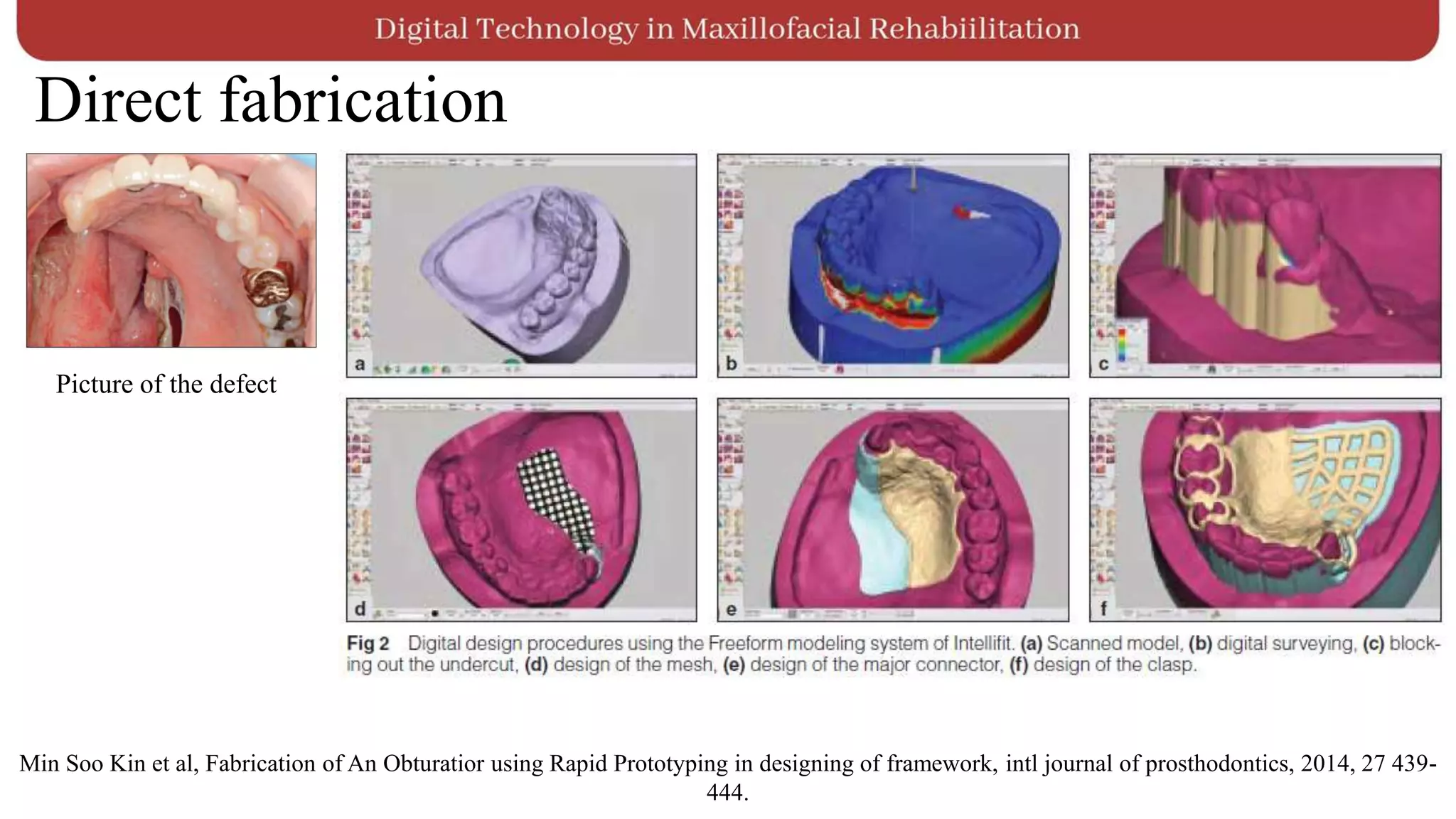 Digital technology in maxillofacial rehabiltation | PPTX