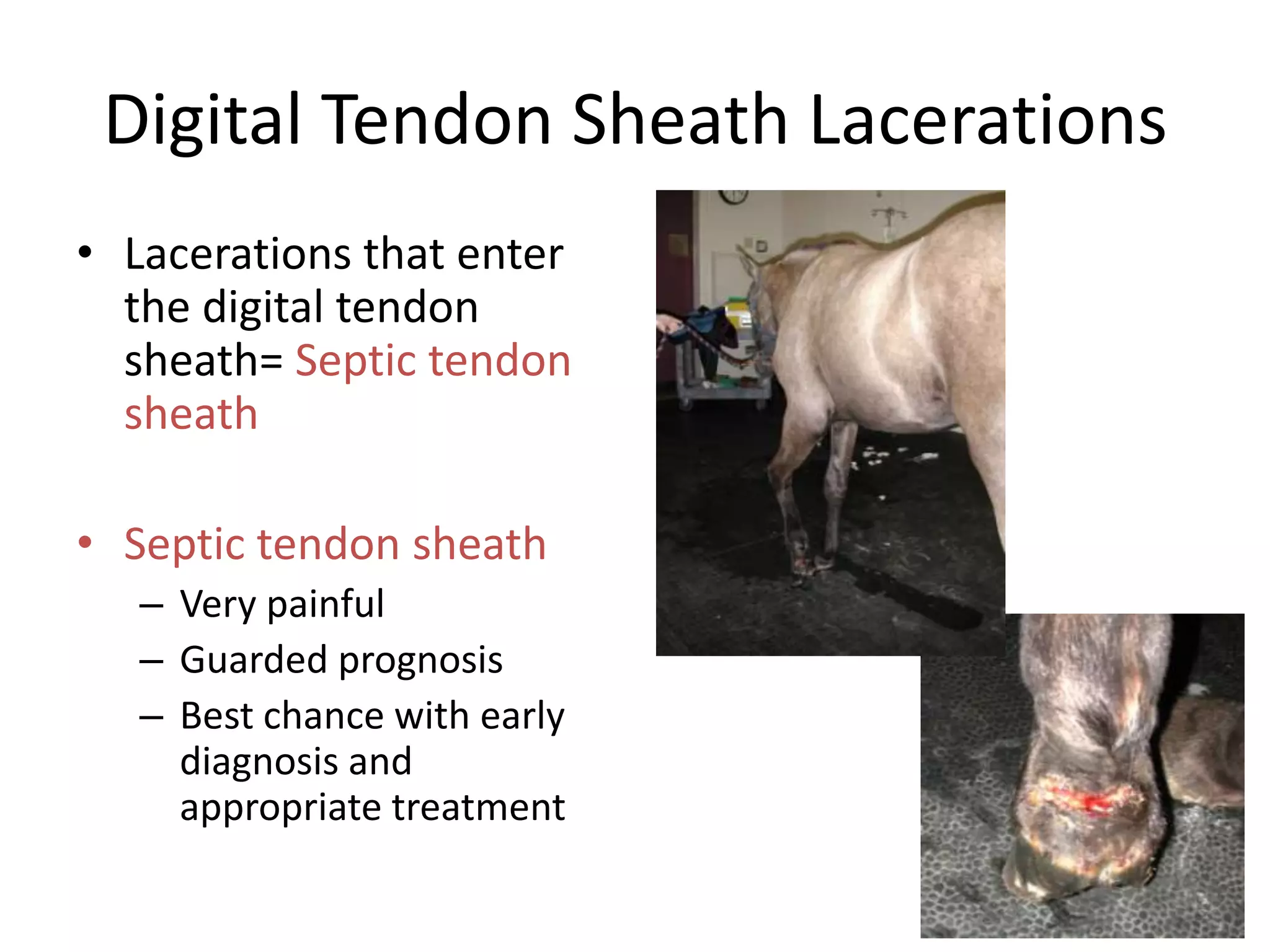 Digital tendon sheath lacerations | PPT