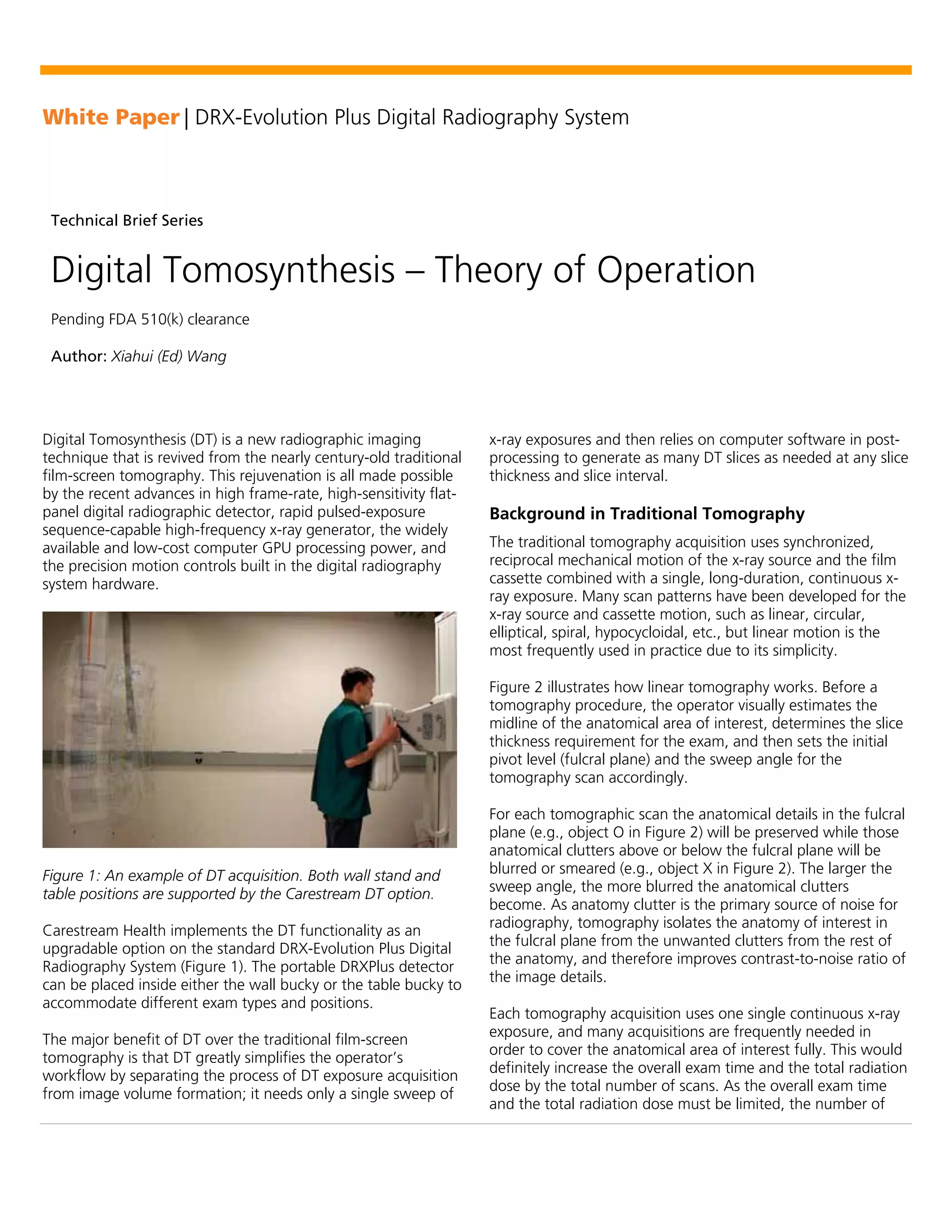 Digital Tomosynthesis: Theory of Operation | PDF