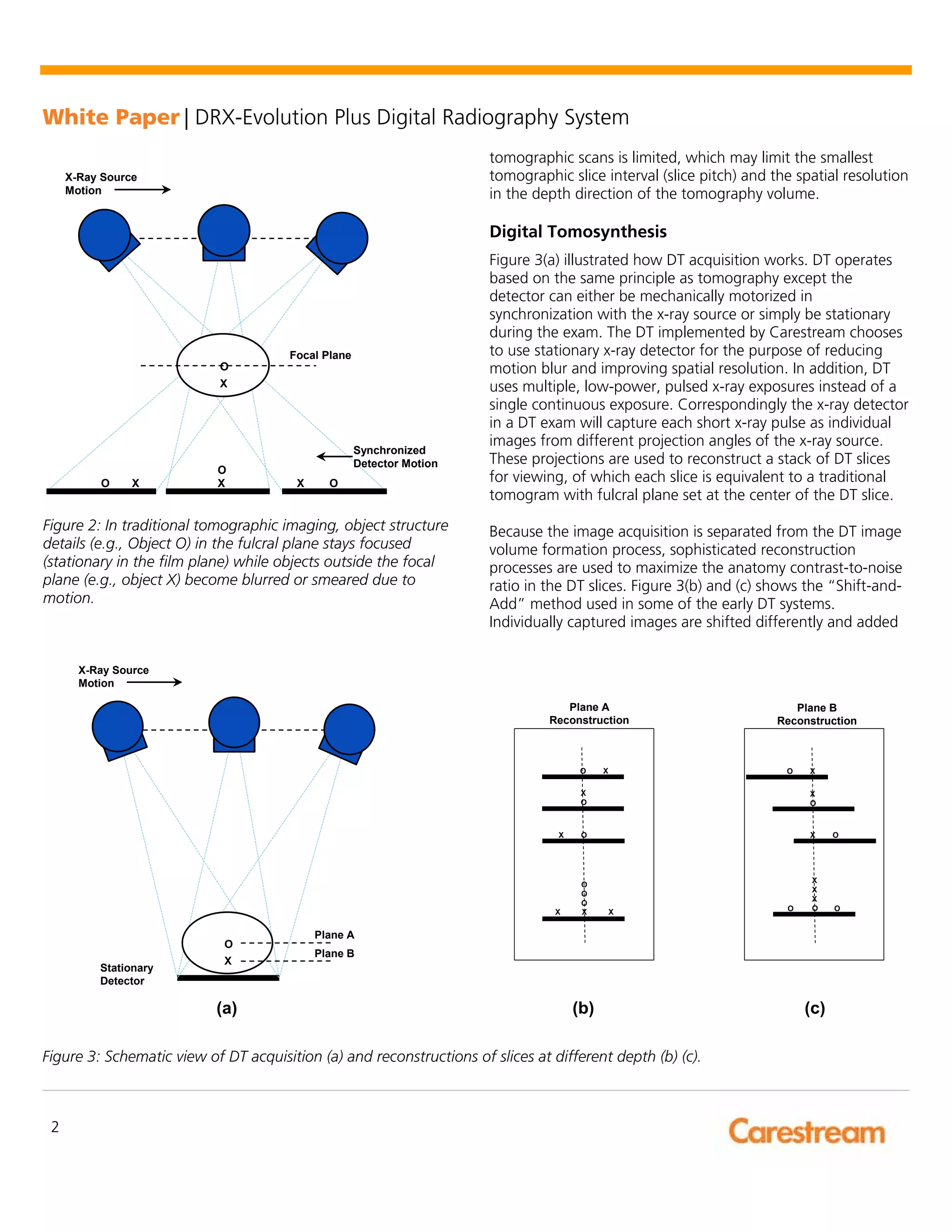 Digital Tomosynthesis: Theory of Operation | PDF