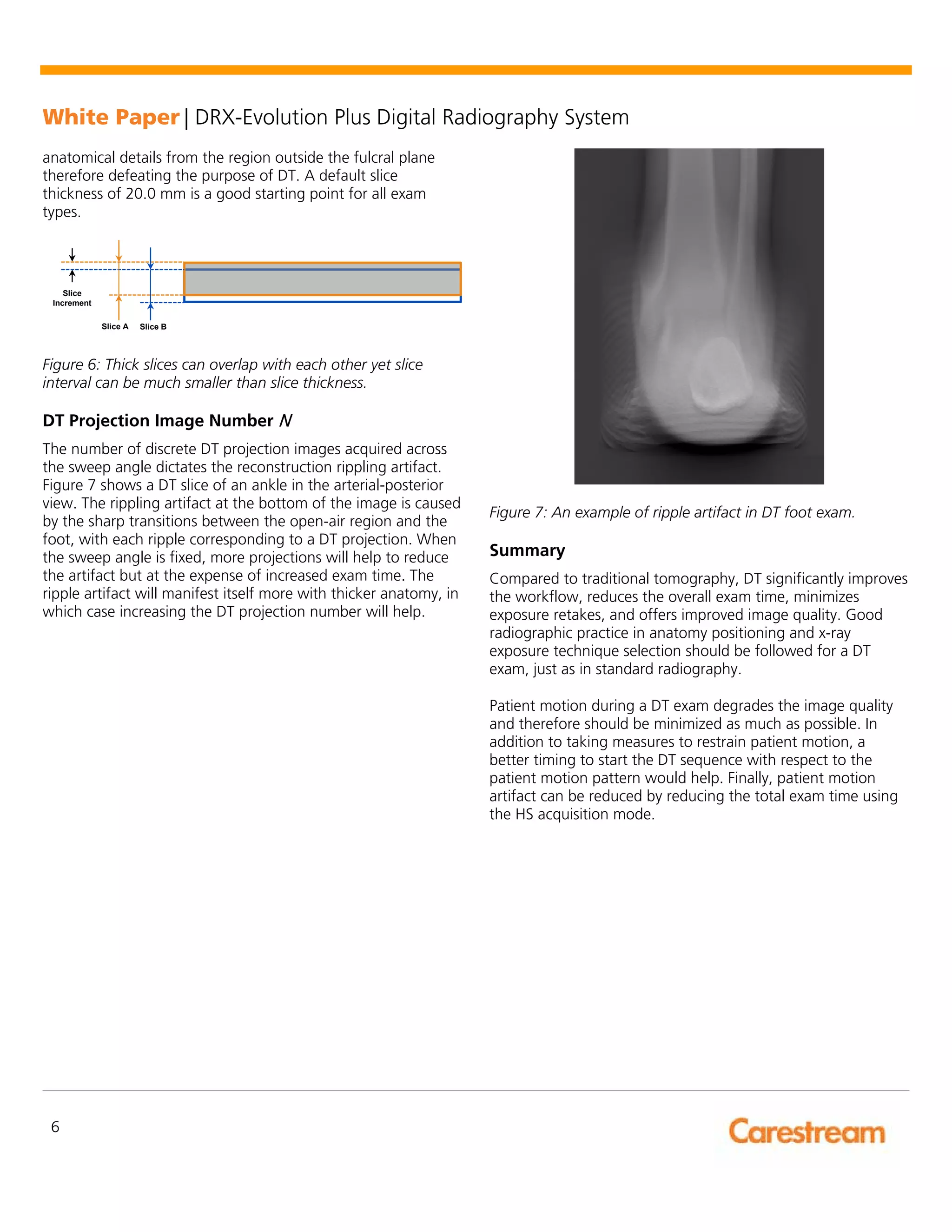 Digital Tomosynthesis: Theory of Operation | PDF