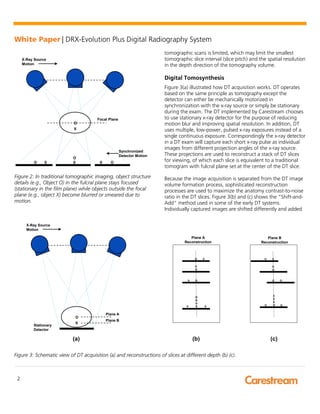 Digital Tomosynthesis: Theory of Operation | PDF