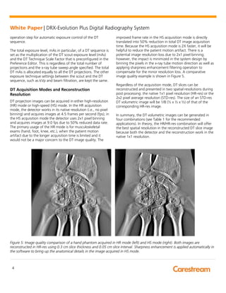 Digital Tomosynthesis: Theory of Operation | PDF