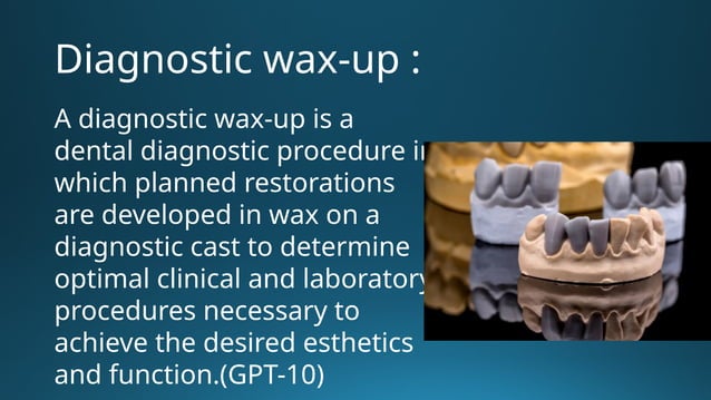 Digital vs physical mockup.pptx dentistry | PPT