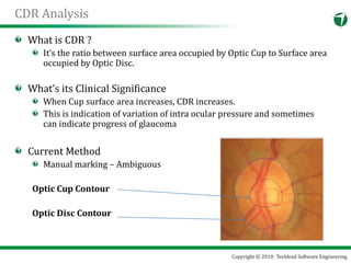 Digitech Ophthalmologist (Techlead Image Processing) | PPT