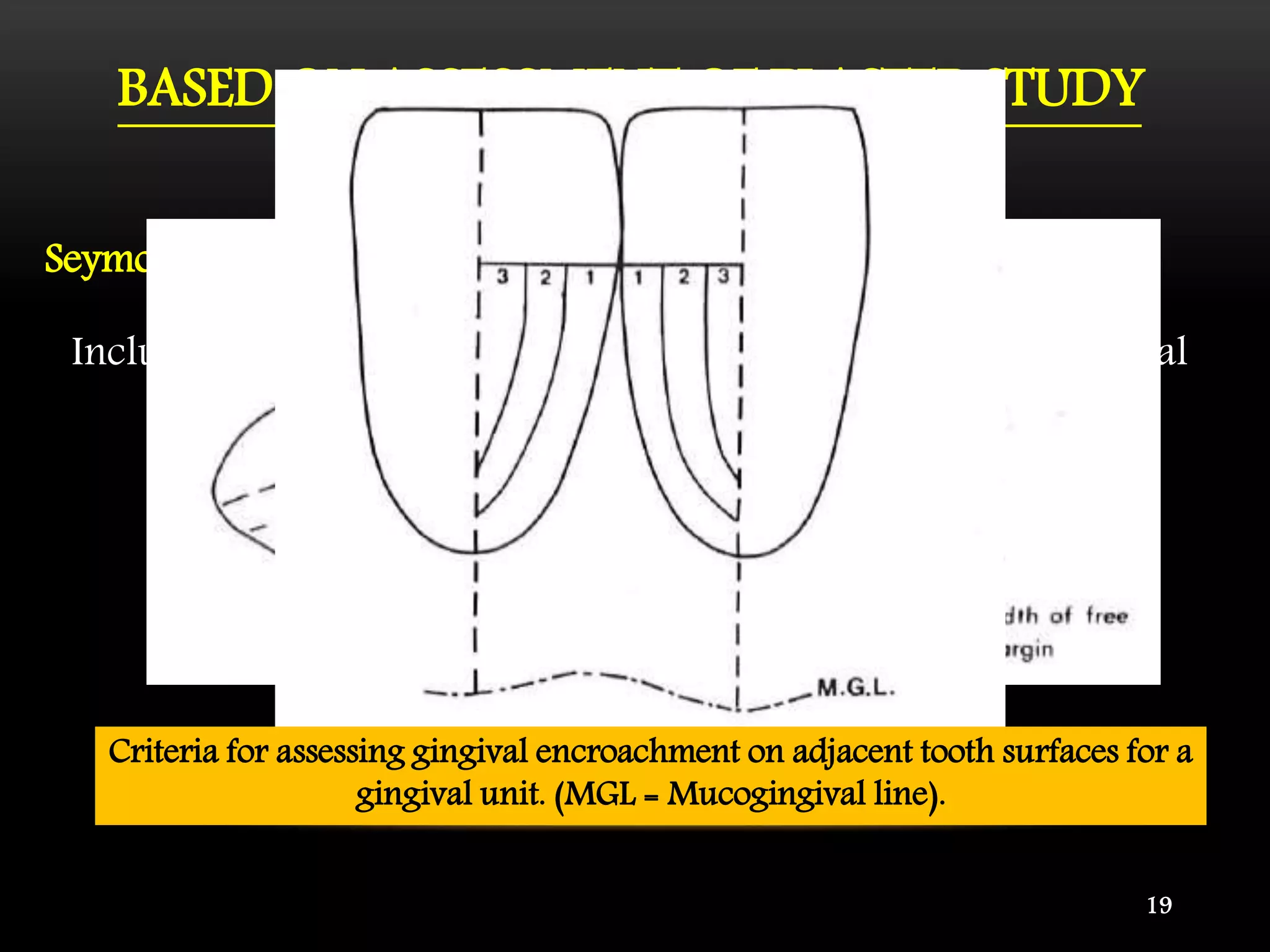 DRUG INDUCED GINGIVAL ENLARGMENT (DIGO) | PPTX