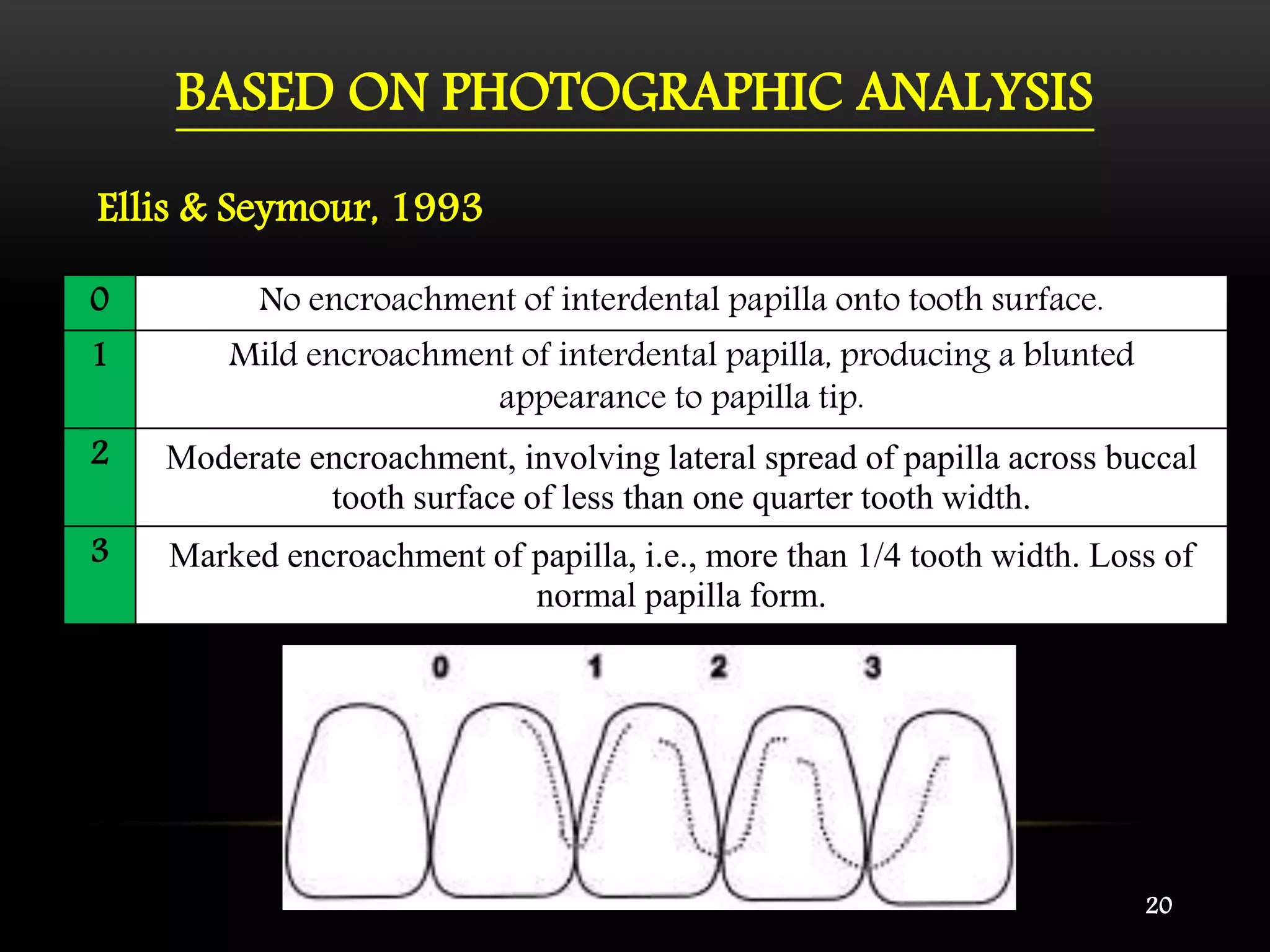 DRUG INDUCED GINGIVAL ENLARGMENT (DIGO) | PPTX