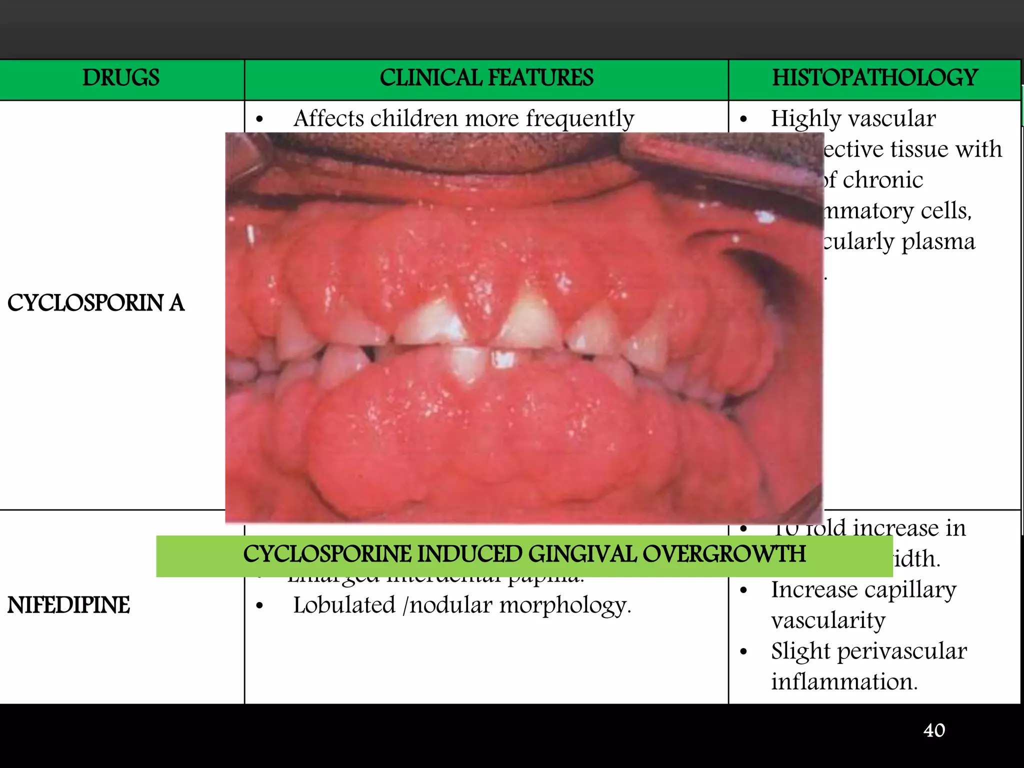 DRUG INDUCED GINGIVAL ENLARGMENT (DIGO) | PPTX