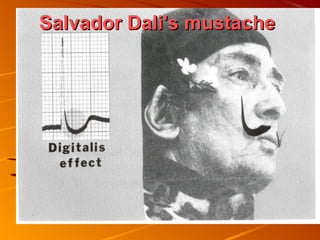 Salvador Dali Mustache Ekg