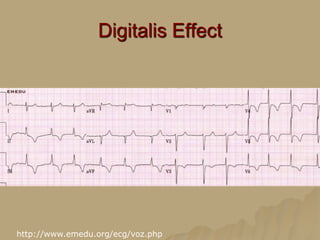 Digoxin- GLYCOSIDE | PPTX