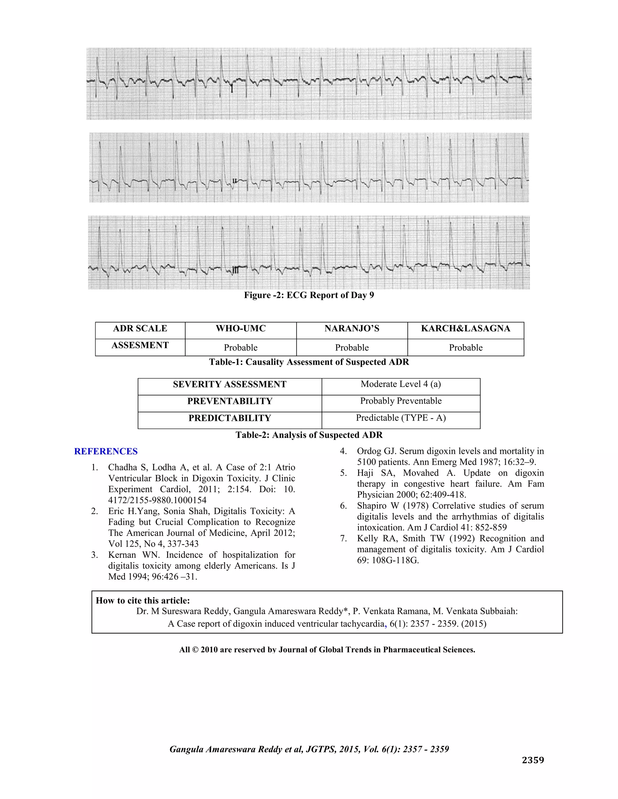 A CASE REPORT OF DIGOXIN INDUCED VENTRICULAR TACHYCARDIA | PDF