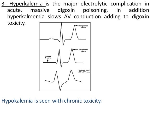 Digoxin toxicity