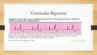 Digoxin toxicity | PPTX