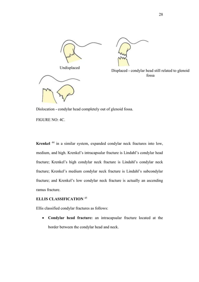 Patterns of condylar fractures | DOC