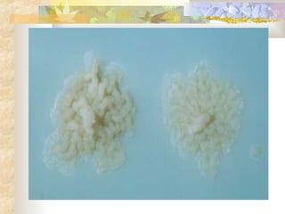 Dijagnostika na tuberkuloza | PPT