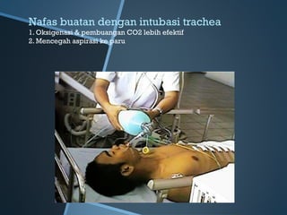 diklat Manajemen Airway dan Intubasi.pptx