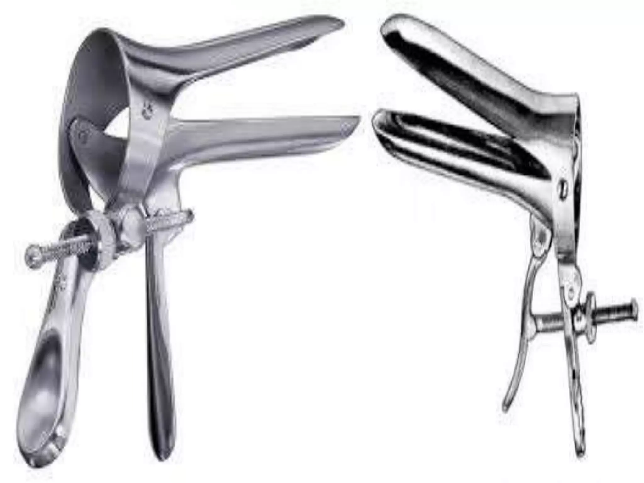 Dilatation and curettage | PPTX