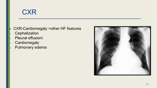 dilated cardiomyopathy.pptx