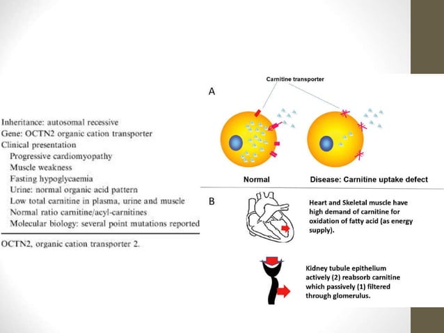 Dilated CMP case presentation and treatment .ppt