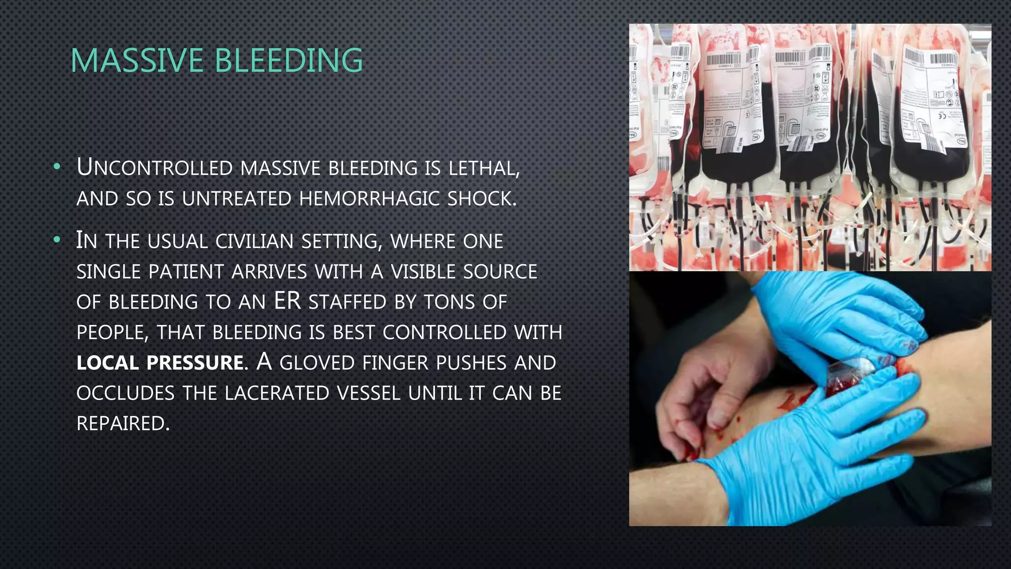Hemorrhage and Shock in Surgery | PPTX