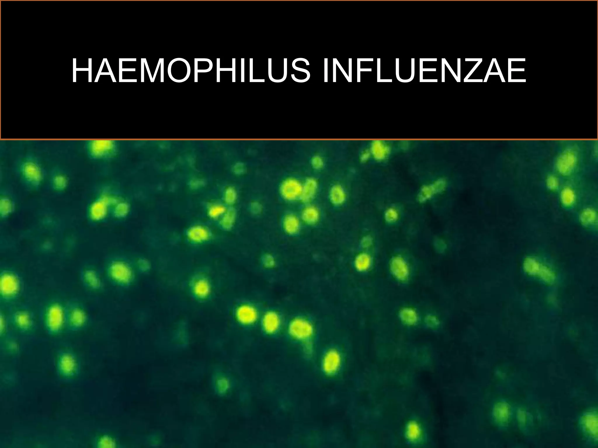 Haemophilus influenzae | PPTX