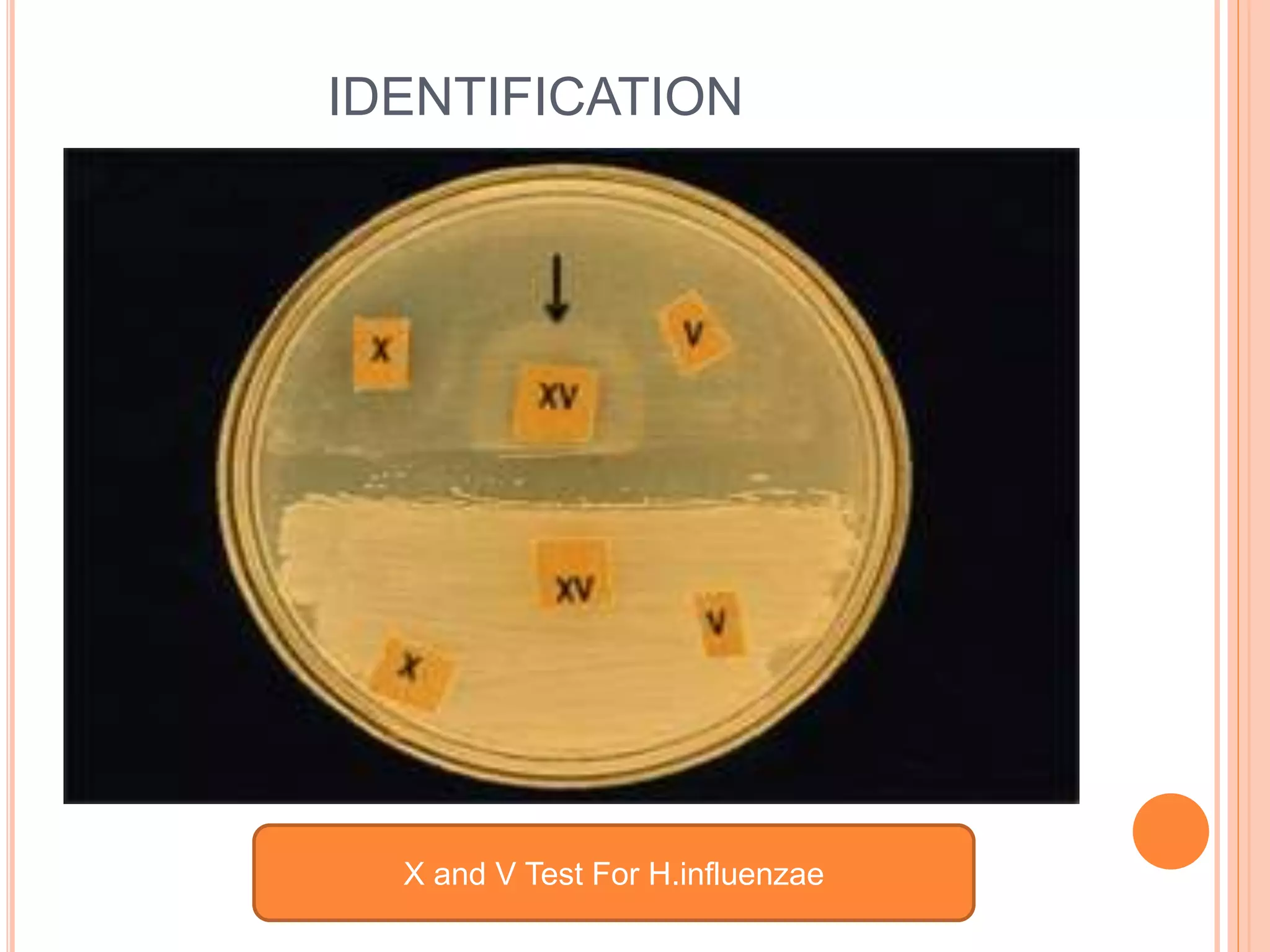 Haemophilus influenzae | PPTX