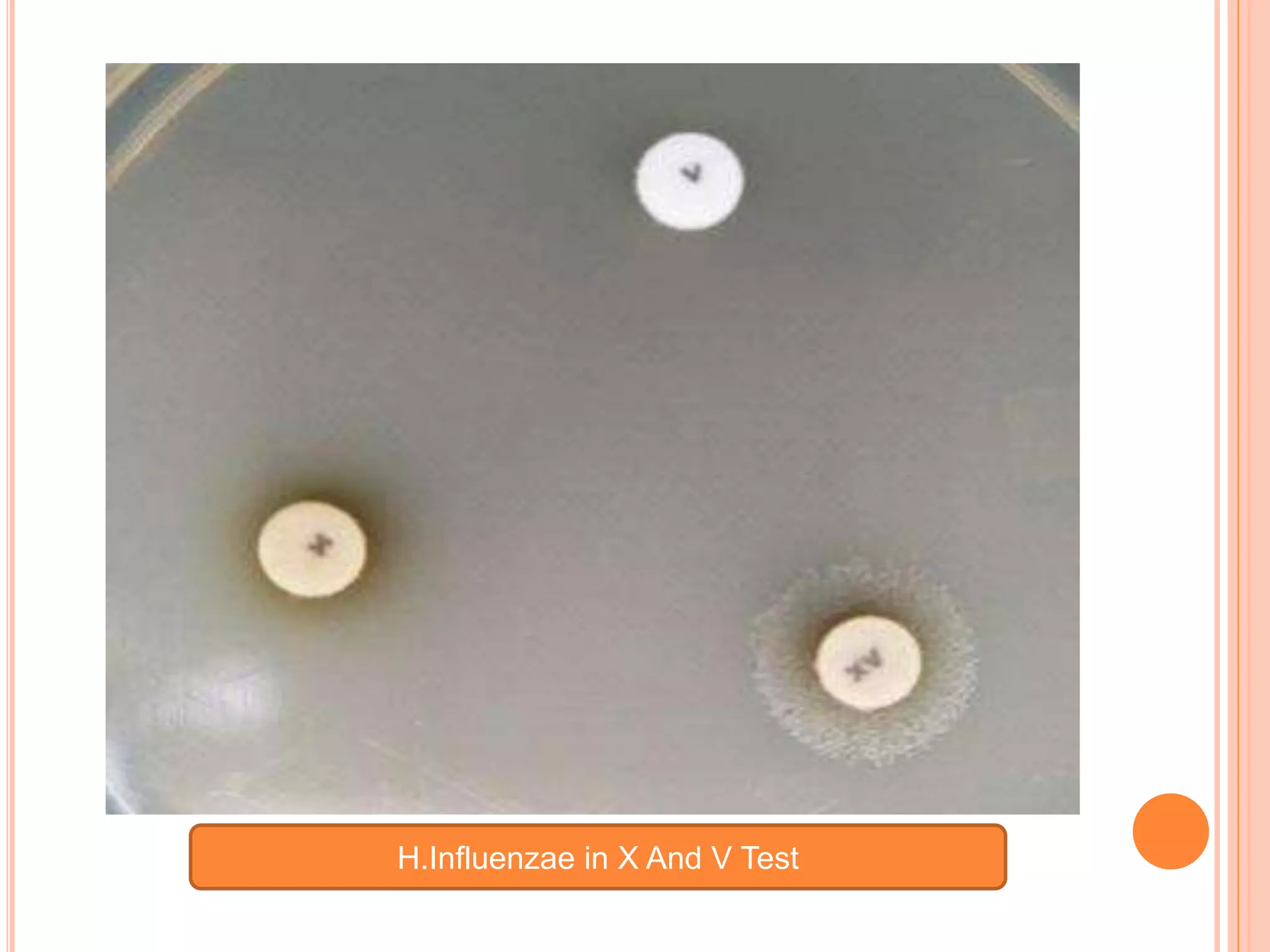 Haemophilus influenzae | PPTX