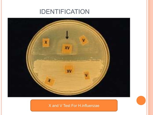 Haemophilus influenzae | PPTX | Lung and Respiratory Health | Diseases ...