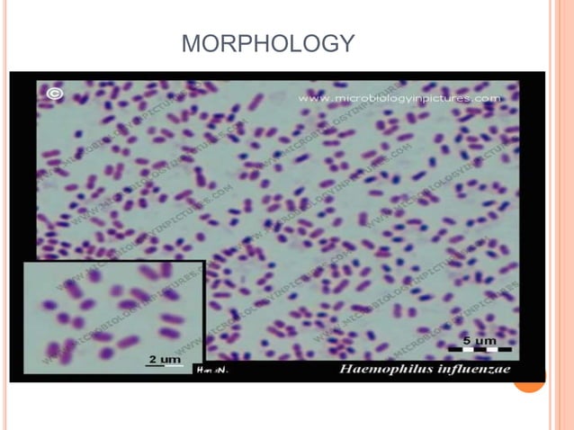 Haemophilus influenzae | PPTX | Lung and Respiratory Health | Diseases ...