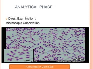 Haemophilus Parainfluenzae Gram Stain