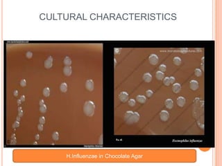 Haemophilus Influenzae Chocolate Agar