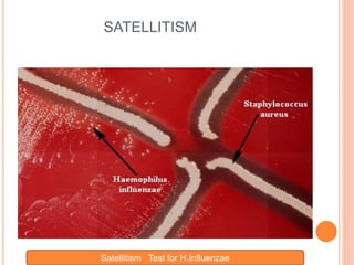 Haemophilus Influenzae Satellitism