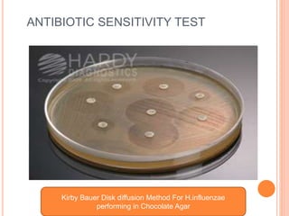 Haemophilus Influenzae Chocolate Agar