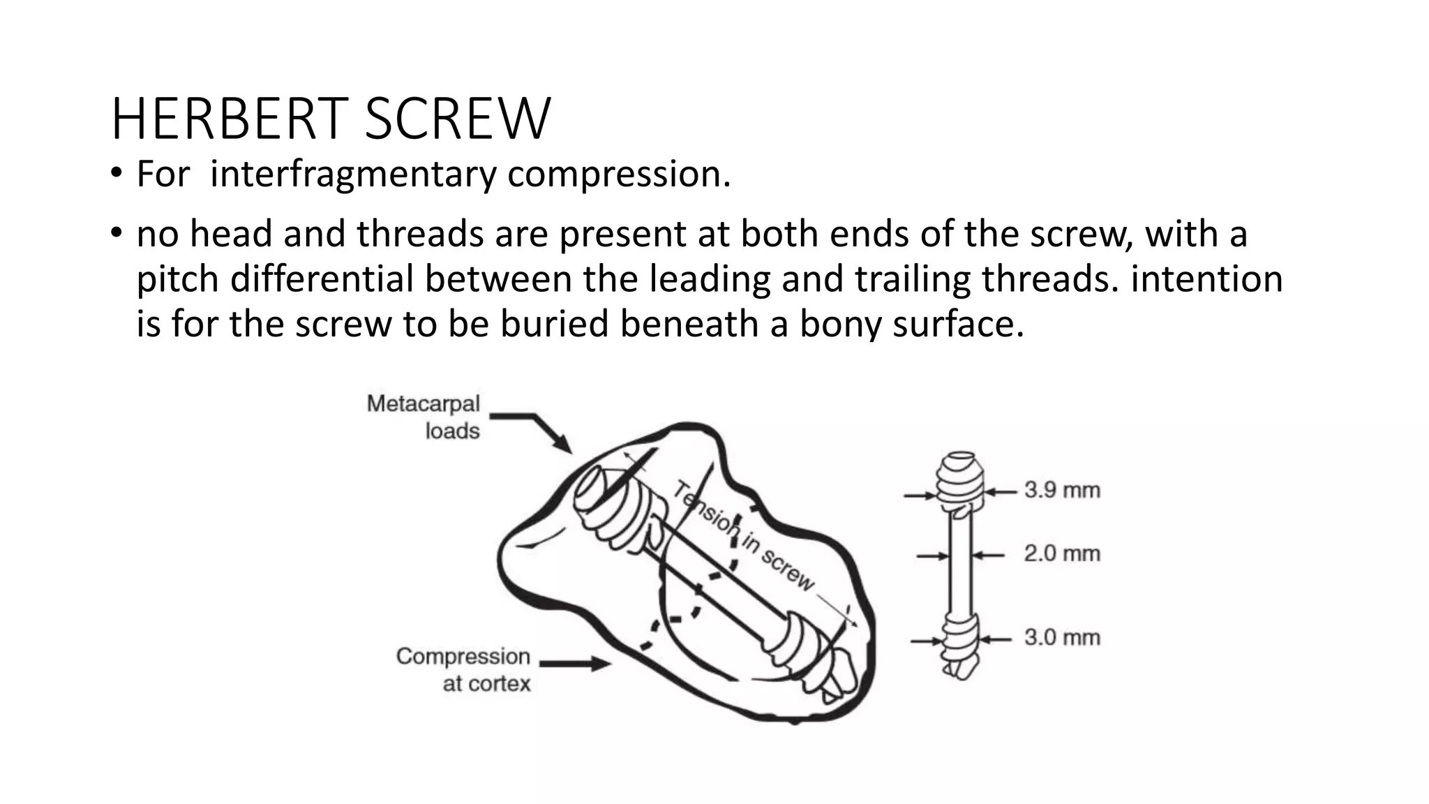 screws and plate | PPTX