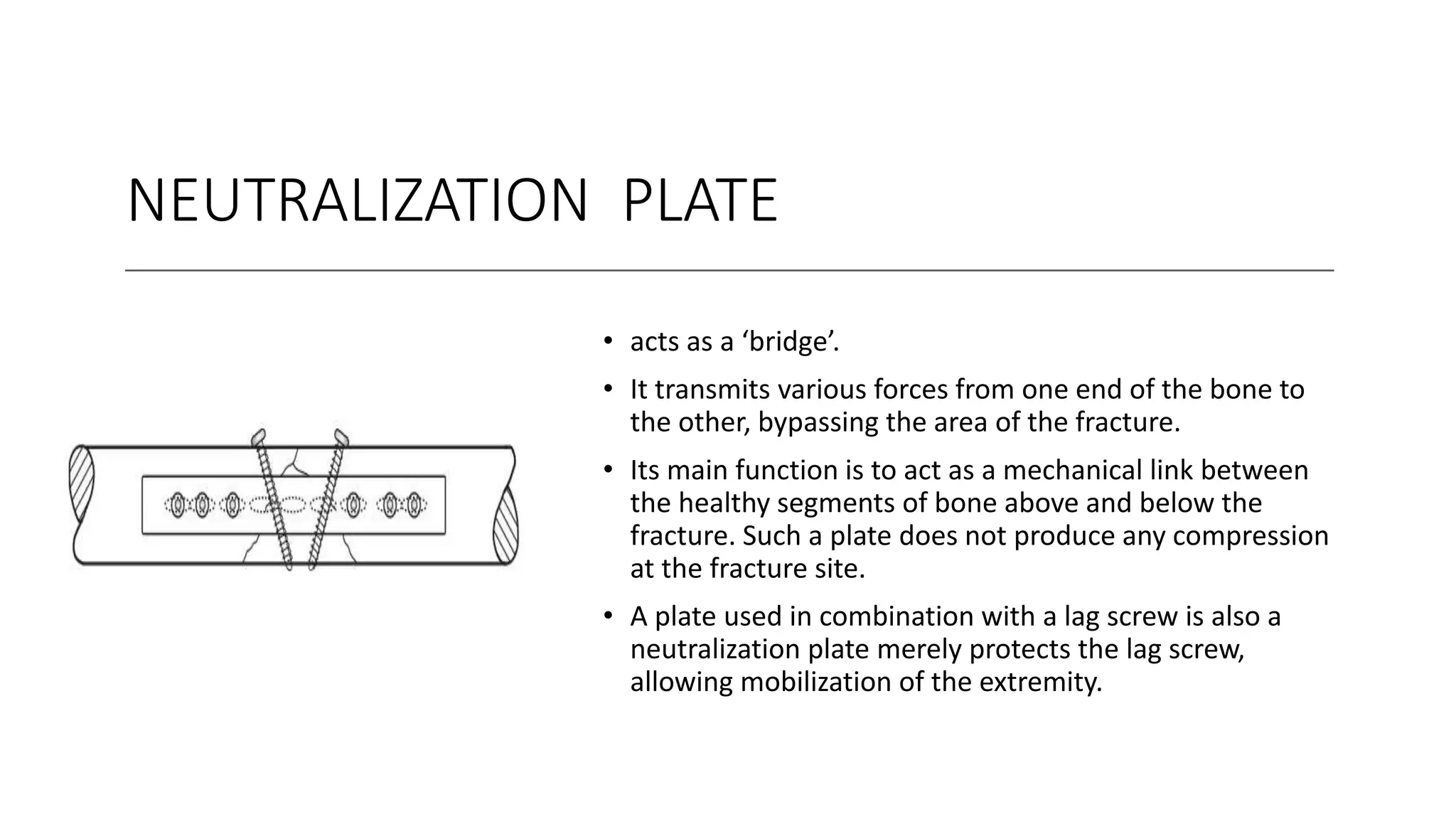 screws and plate | PPTX
