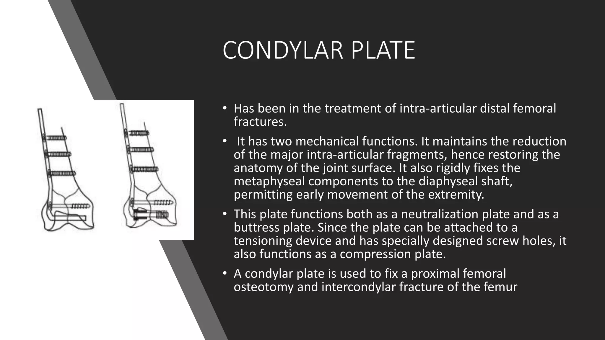 screws and plate | PPTX