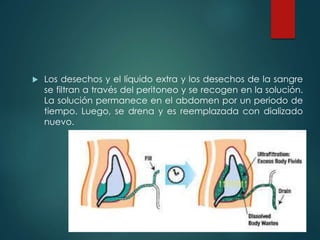 Diálisis peritoneal-topicos | PPTX