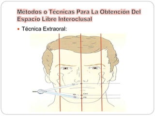 Dimensión Vertical.pptx